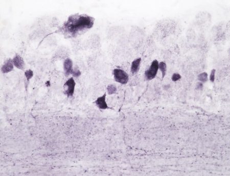 The Neural Network Of An Octopus Arm - Science Trends