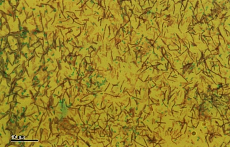 Eubacteria Examples | Science Trends