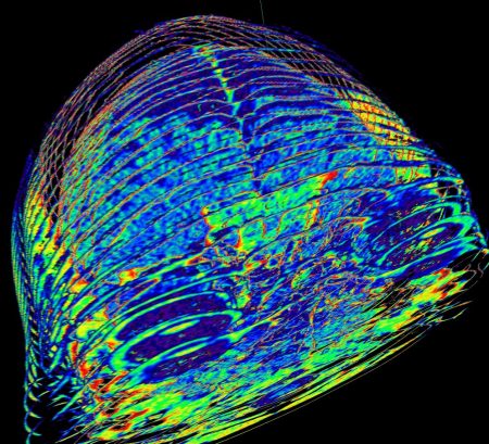 The Dark Matter Of The Brain Lights Up! - Science Trends