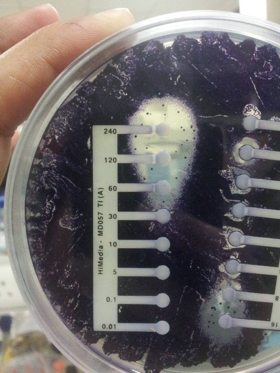 Death Of The Superbug: Using Computer Models To Identify Mechanisms And ...