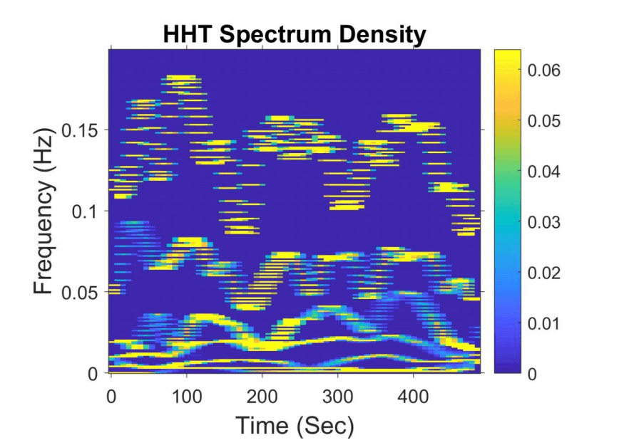 A Closer Look At Brain Signals In Aging Brains - Science Trends