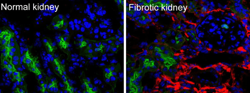 Working From Cultured Cells To Identify Novel Guardian In The ...
